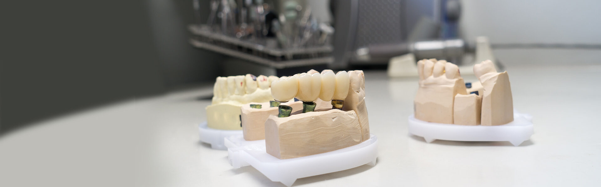 White Zirconia Crowns - Action Dental + Kids